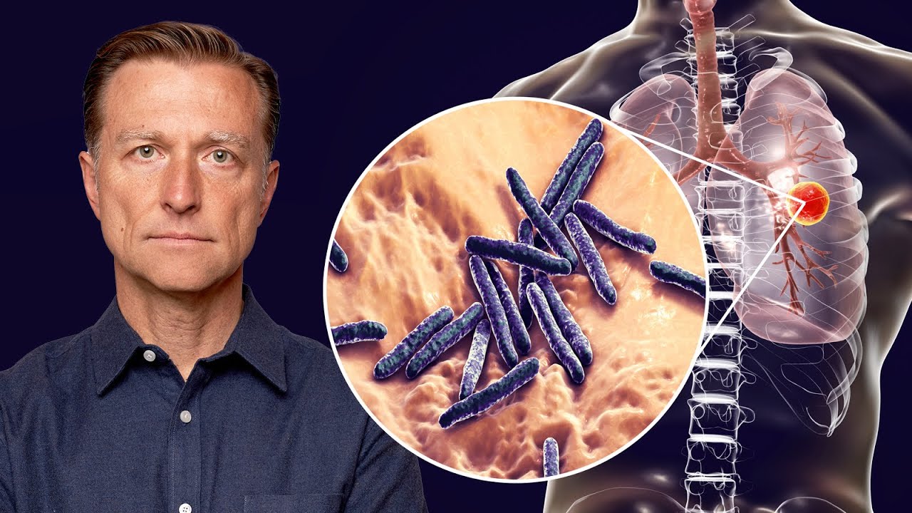 The DEADLIEST Bacteria In The World - Dr. Berg